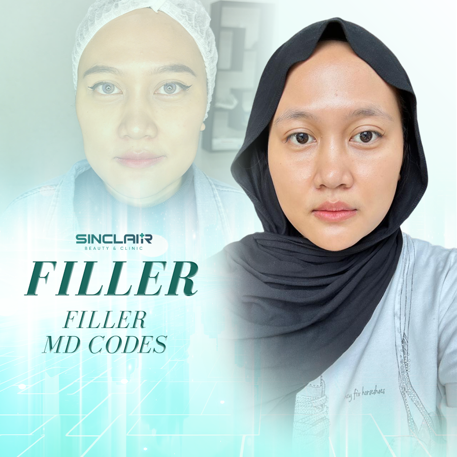 Filler - Klinik Utama Sinclair